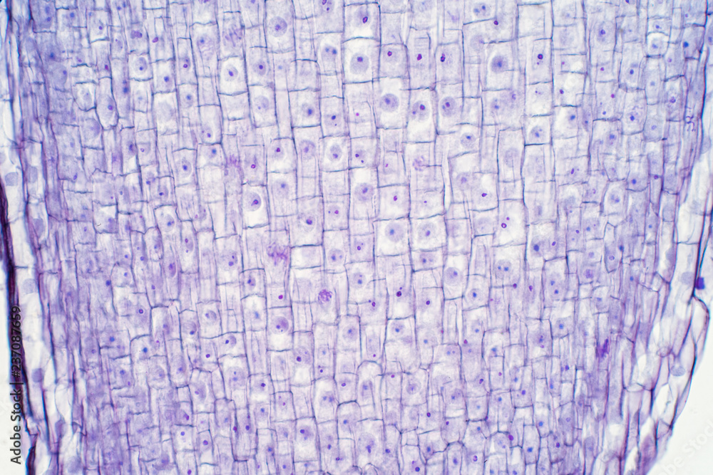 Root tip of Onion and Mitosis cell in the Root tip Stock Photo | Adobe ...