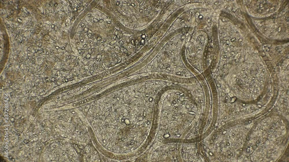 nematode worm colony, which is used to feed fish fry, under a ...