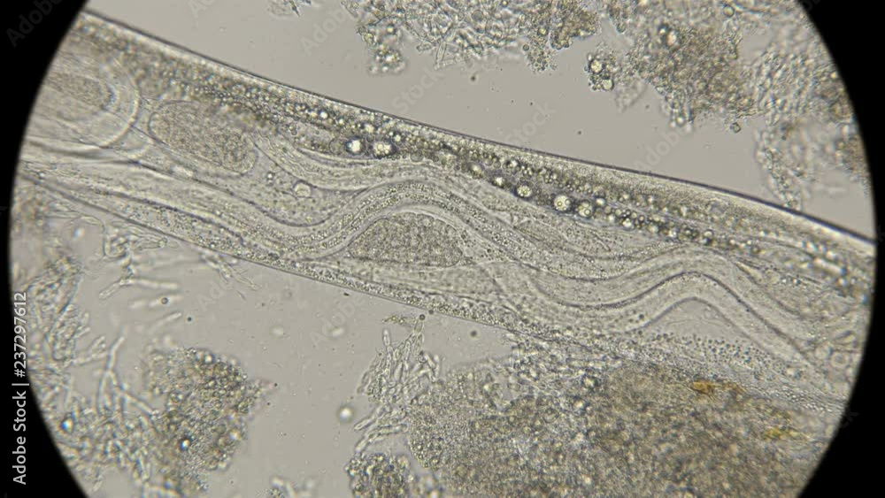 young nematodes inside the female acetic eel Turbatrix aceti, which are ...