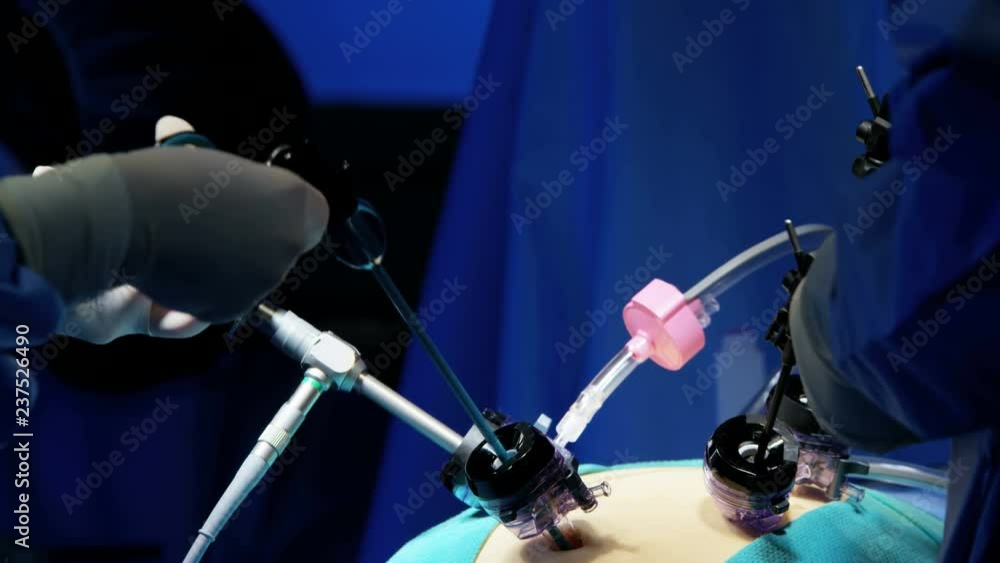 Laparoscopic surgical operation in hospital theatre using Endoscopy and ...