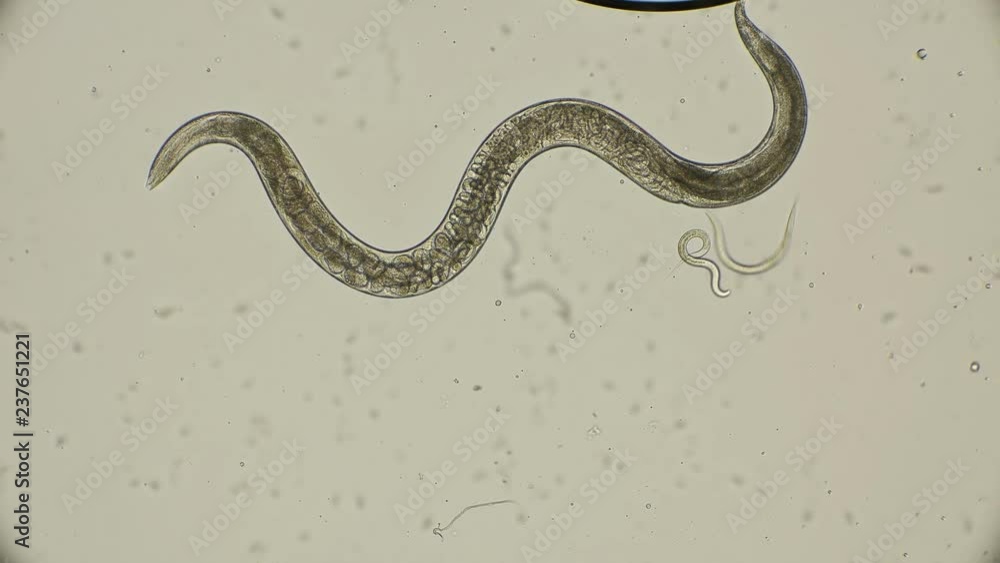 The female roundworm Turbatrix aceti gives birth to a formed nematode ...