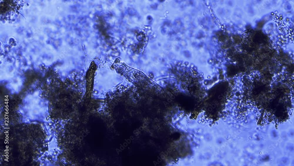 Rotifer Protozoan Feeding Phase Contrast Microscope 200x Blue Filter ...