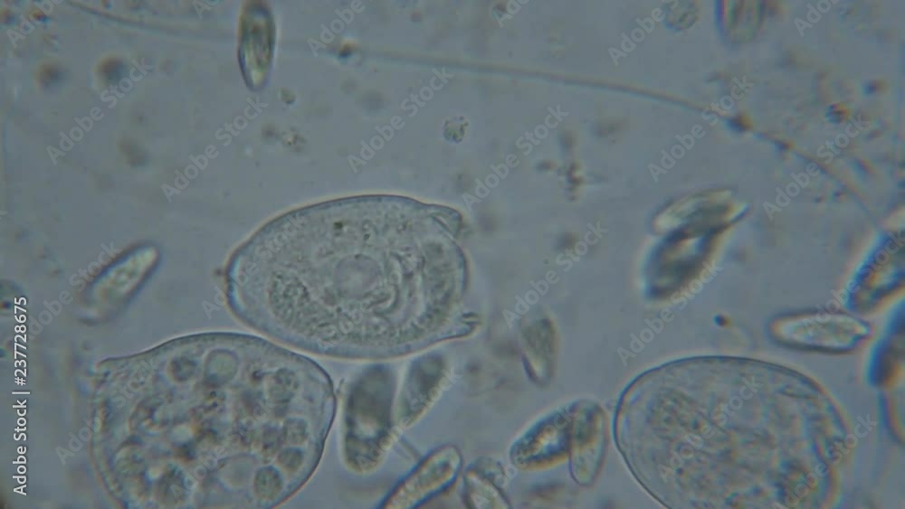 Microbes in a drop of fresh water from a lake. Vorticella (organism) in ...
