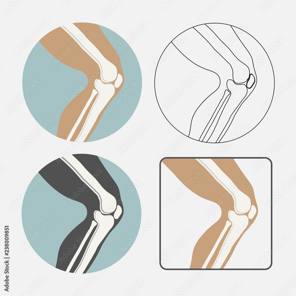 Human knee joint icon set, logo for orthopedic clinic, flat styl Stock ...