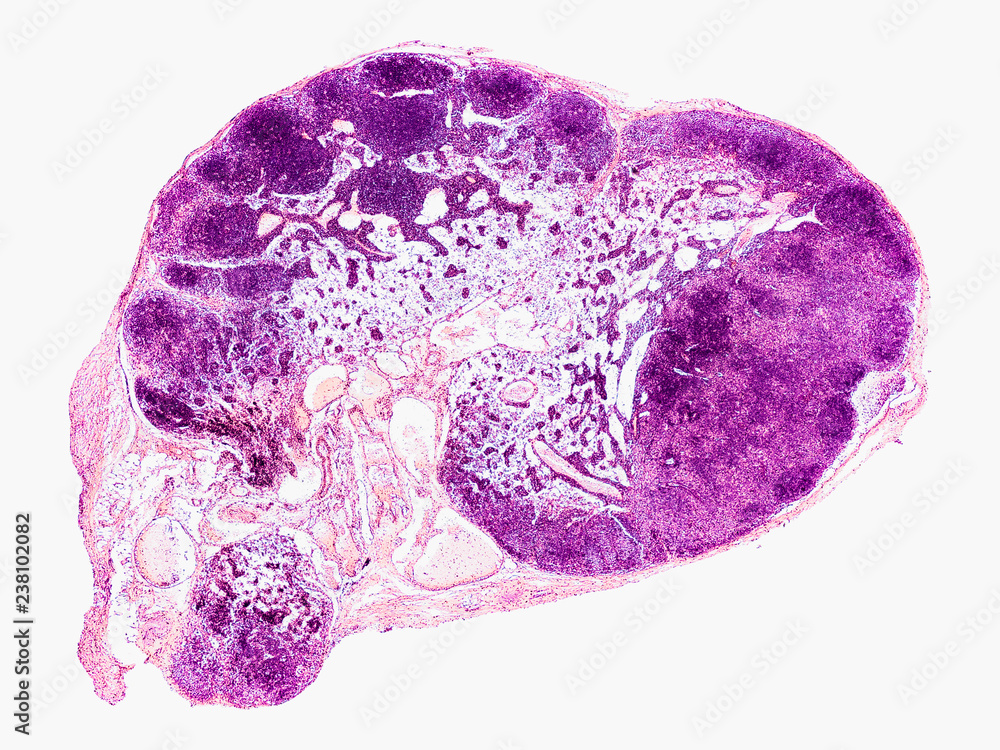 lymphonodus - cross section cut under the microscope – microscopic view ...