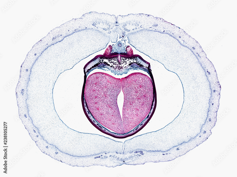 phaseolus vulgaris bean with attaced ovule - cross section cut under ...