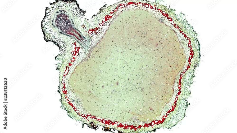 Video „rhizobium soybean root with unattached nodule - cross section ...