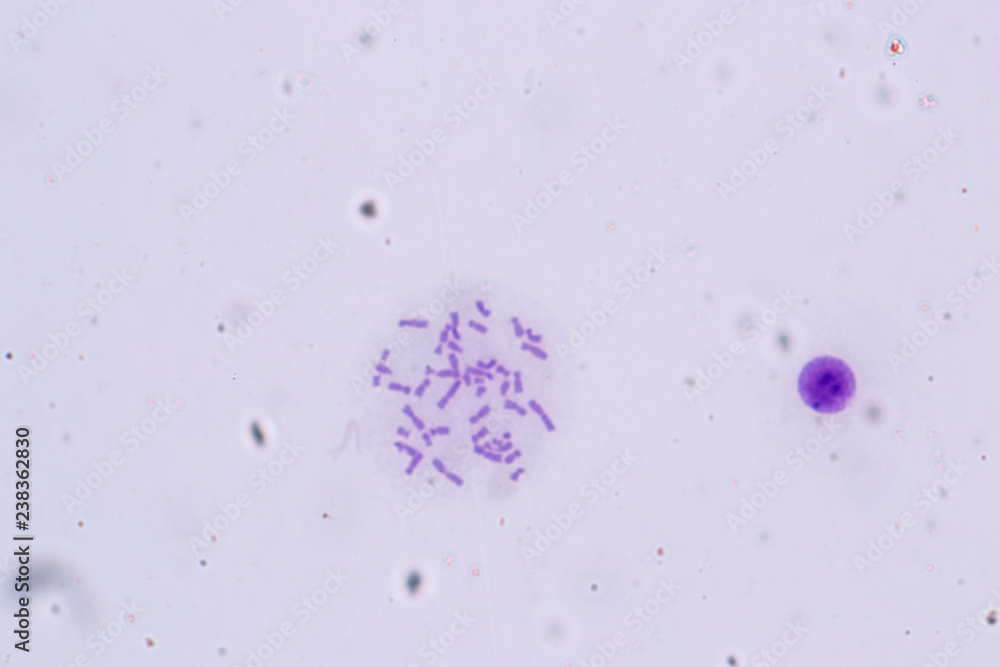 Chromosomes Human under the microscope for education. Stock Photo ...