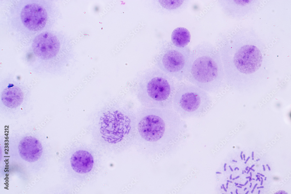 Chromosomes Human under the microscope for education. Stock Photo ...