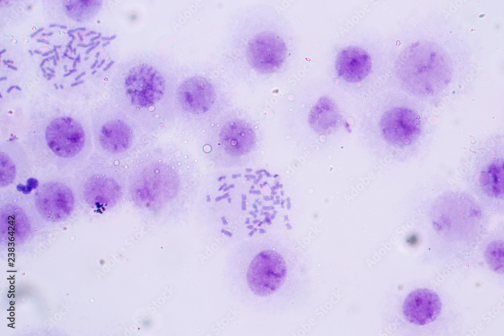 Chromosomes Human under the microscope for education. Stock Photo ...