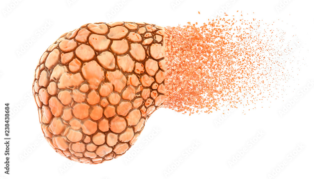 Pancreatic disease concept. 3D rendering Stock Illustration | Adobe Stock