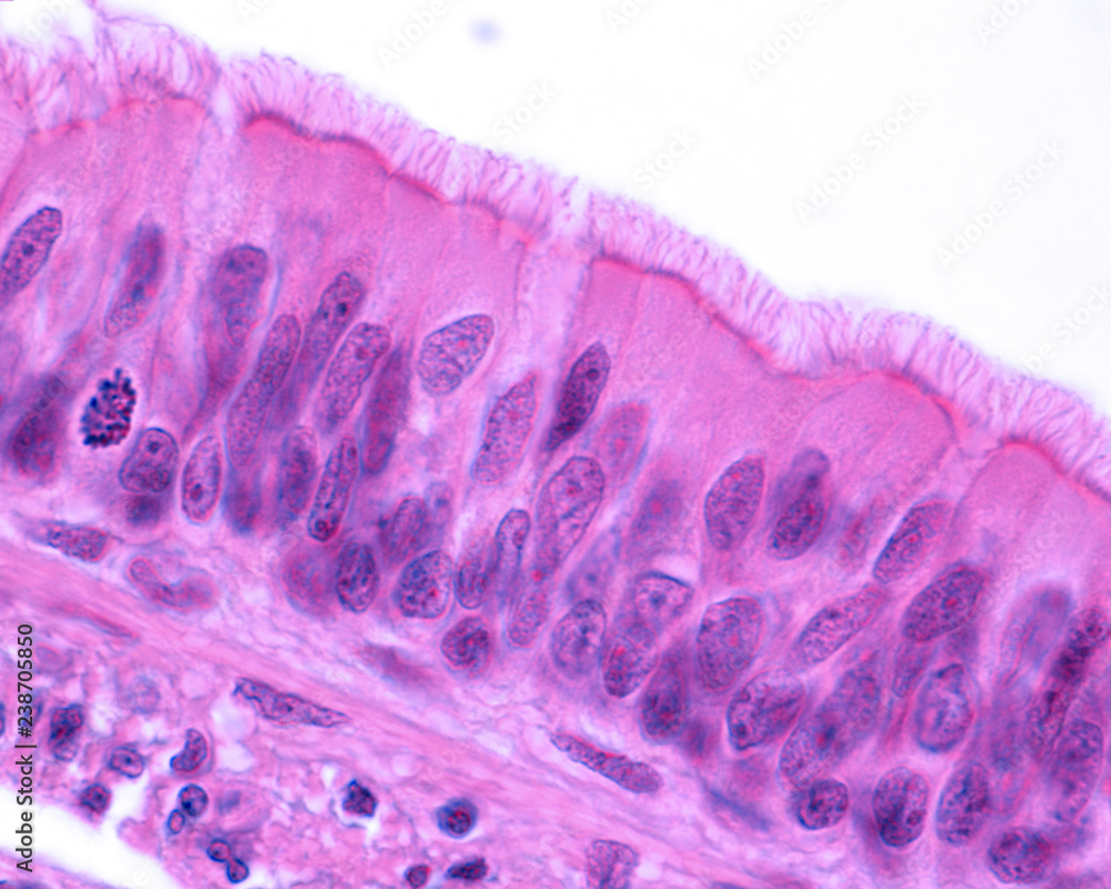Pseudostratified Columnar