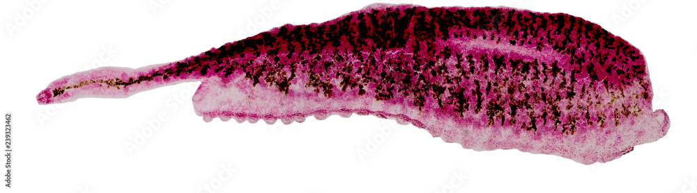 Patterns and backgrounds of Parasitic, Study for Anatomical pathology ...