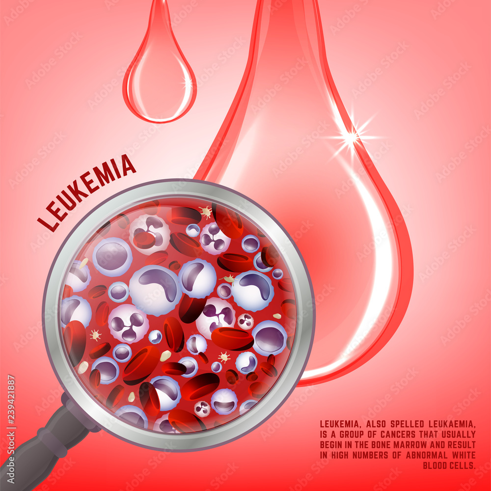 Leukemia vertical background Stock Vector | Adobe Stock