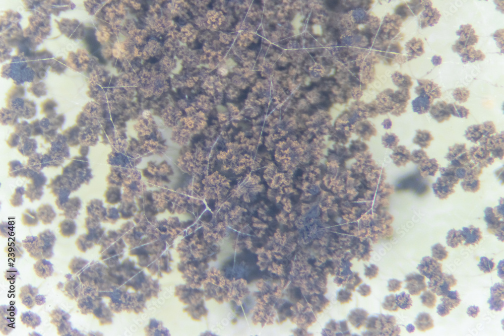 Rhizopus (bread mold) is a genus of common saprophytic fungi,Rhizopus ...