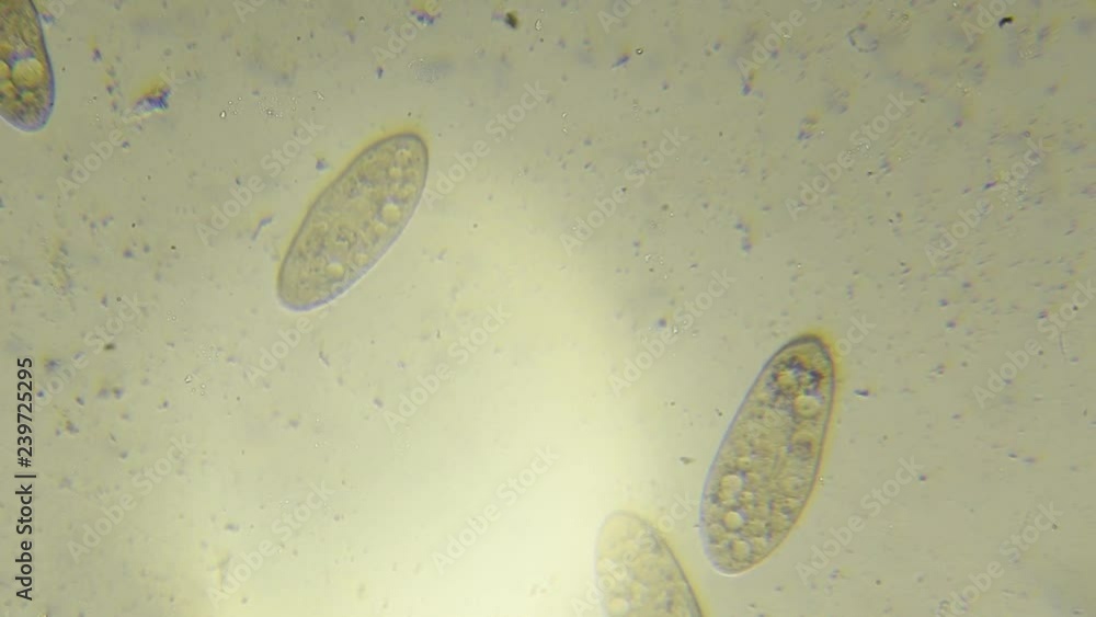 Microscope image footage of protozoa microorganisms in water, showing ...