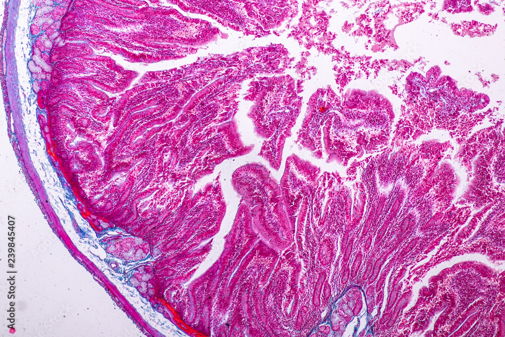 Tissue of small intestine or small bowel under the microscopic in Lab ...