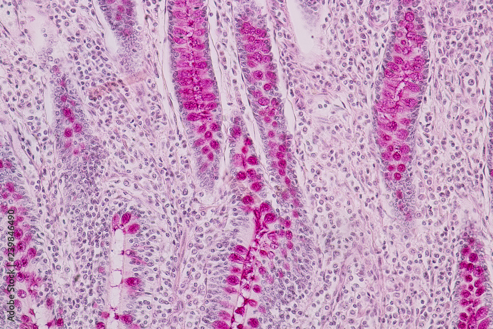Tissue of small intestine or small bowel under the microscopic in Lab ...