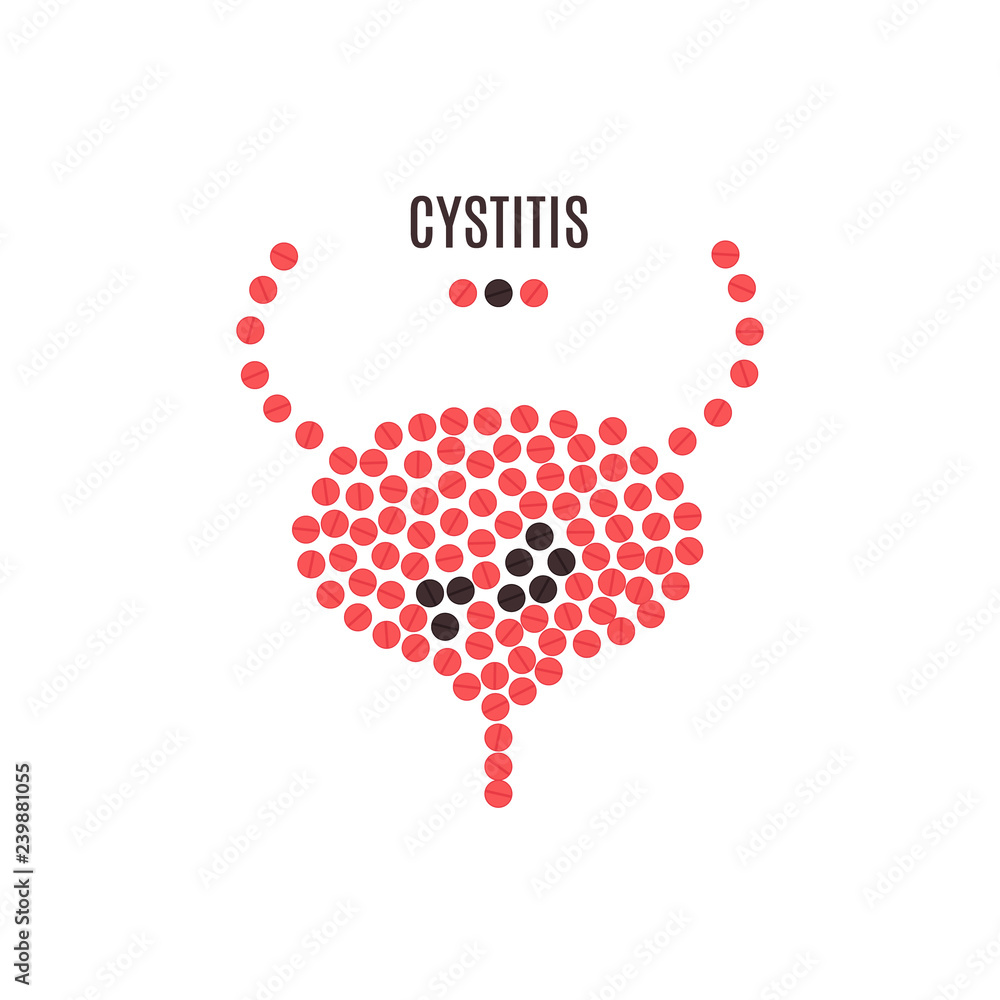 Cystitis awareness vector poster with bladder made of pills on white ...