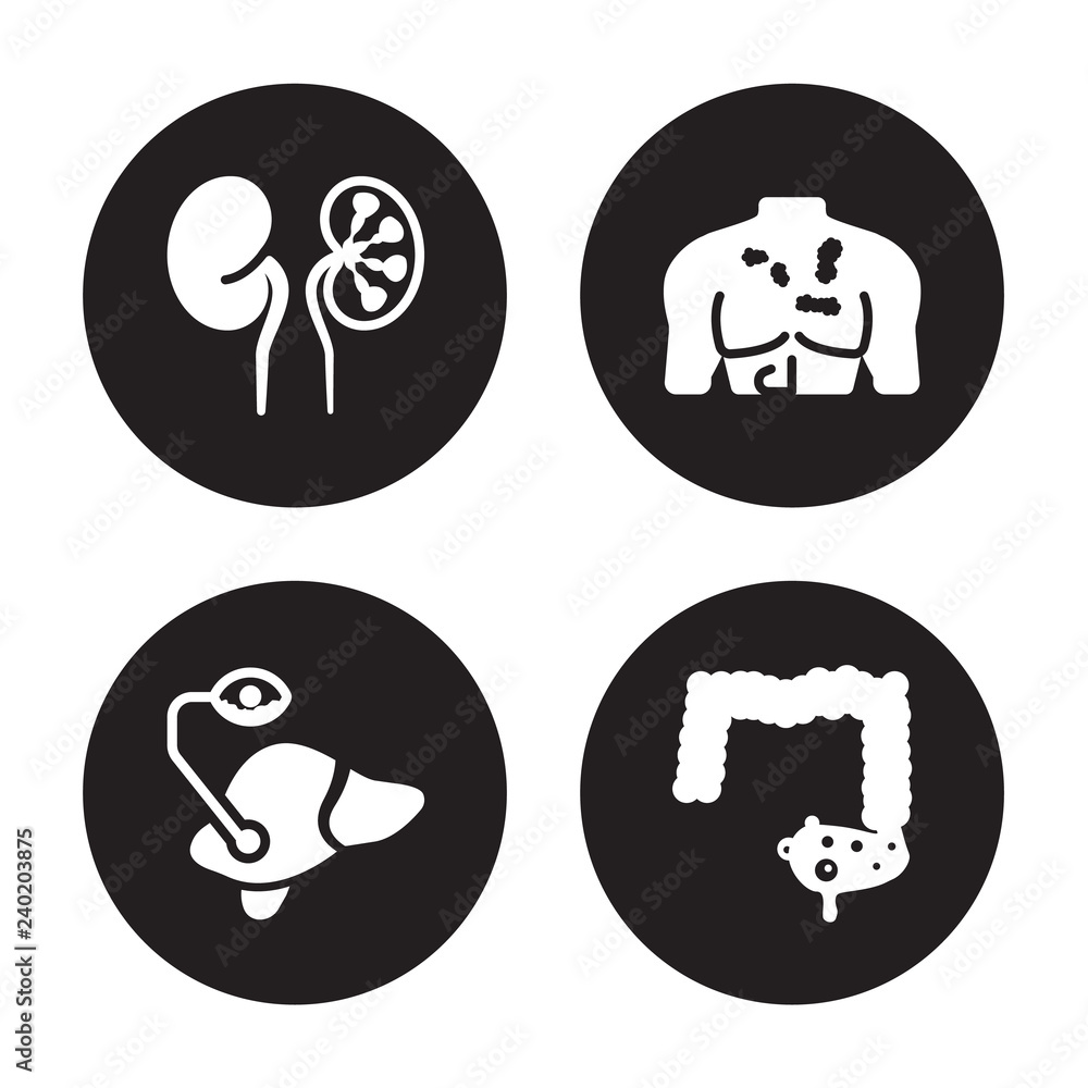4 vector icon set : Iron-deficiency anemia, Interstitial cystitis ...