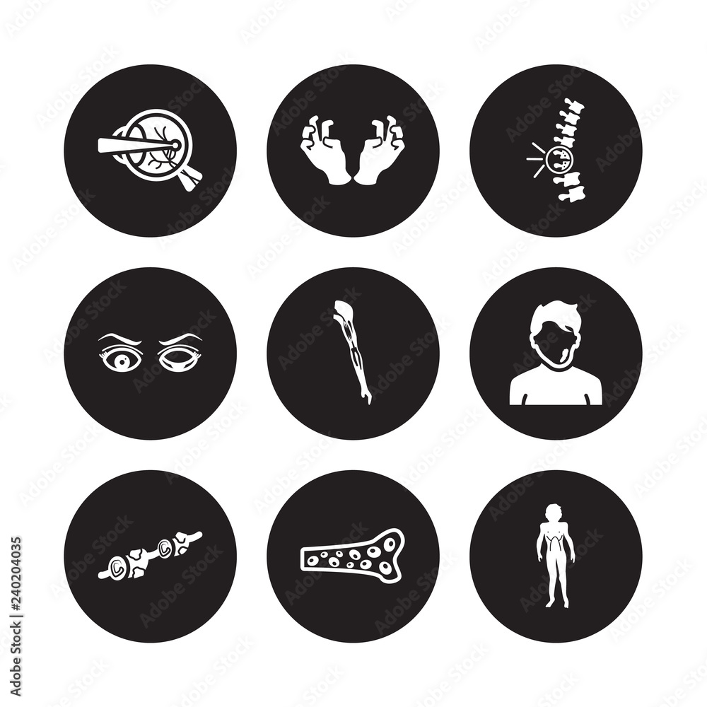 9 vector icon set : Mononucleosis, Migraine, Metastatic cancer ...