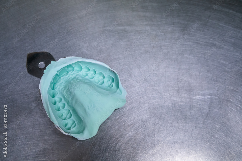 Set of upper and lower jaw dental molds Stock Photo | Adobe Stock