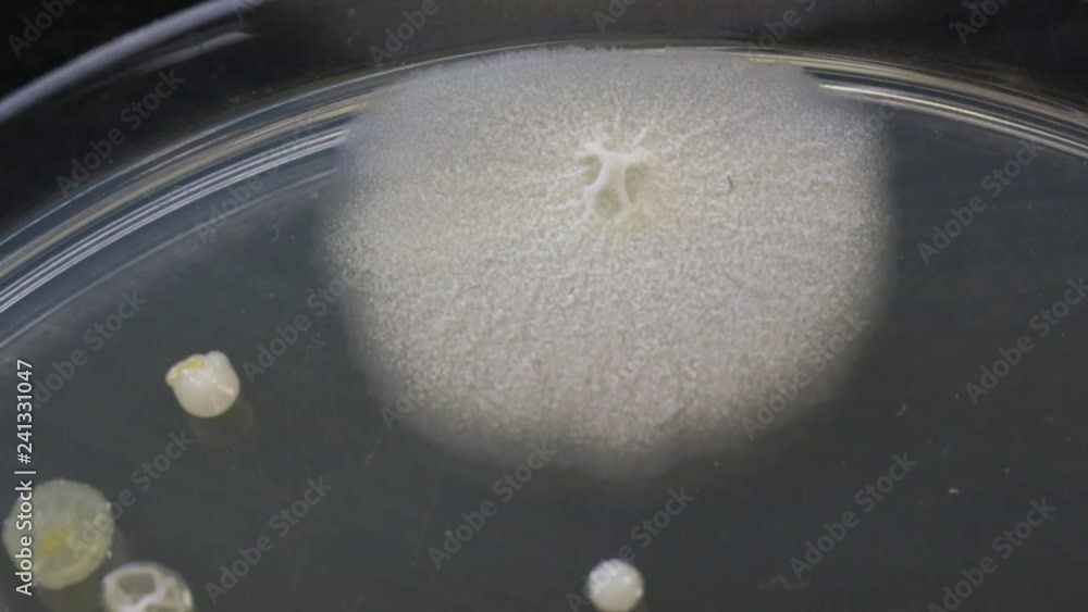 Different shaped colonies of bacteria, yeast and mold growing on agar ...