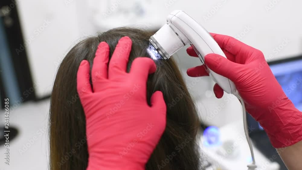 doctor dermatologist diagnoses the structure of the hair of a young ...