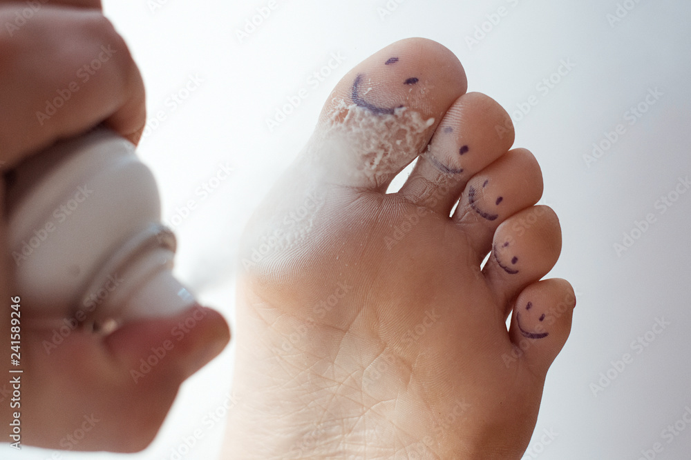 Female toes with painted emoticons and foot cream. Foot care concept ...