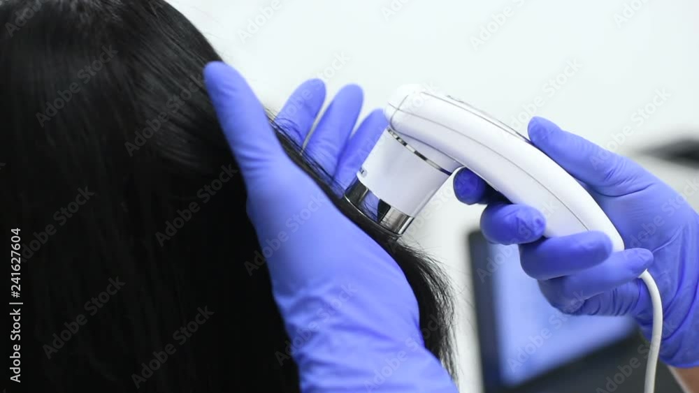 doctor dermatologist diagnoses the structure of the hair of a young ...