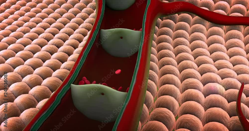 cholesterol in a blood, artery shown with a cut out section ...