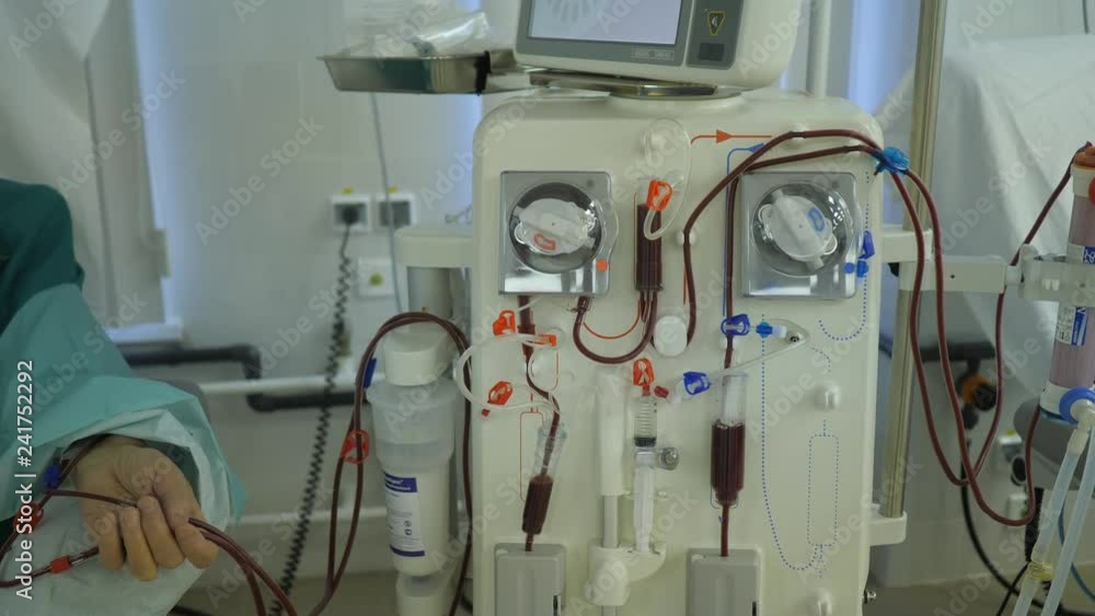 Video „Hemodialysis. Machine artificial kidney. The hand of the patient ...