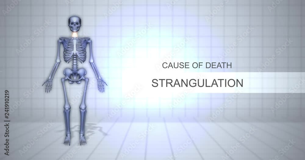 Human Forensic Autopsy Animation Concept - Cause of Death ...