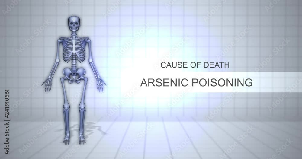 Human Forensic Autopsy Animation Concept - Cause of Death - Arsenic ...