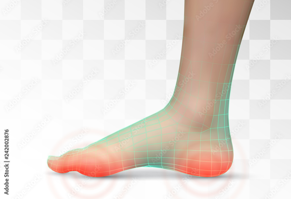 vector human foot.red spots of pain. ready element for medicine and ...