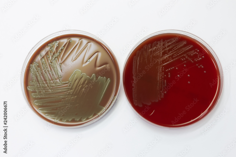 Bacteria in culture media Stock Photo | Adobe Stock