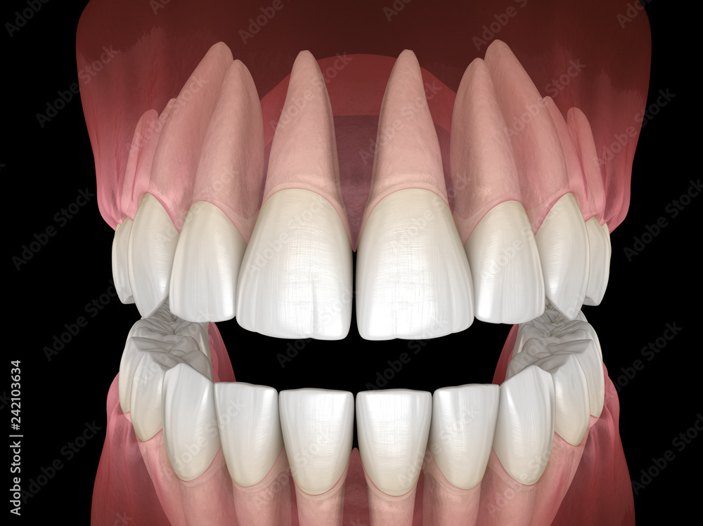 Morphology of mandibular and maxillary human gum and teeth. Medically ...