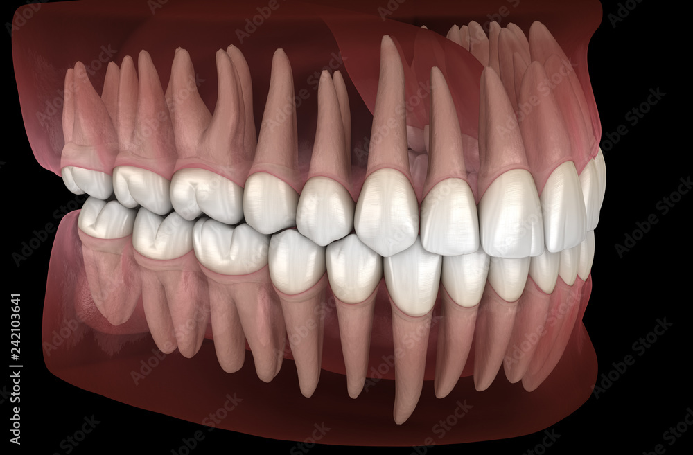Morphology of mandibular and maxillary human gum and teeth. Medically ...