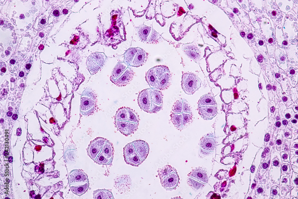 Lily Anther Sporogenous under the microscopic for education in ...