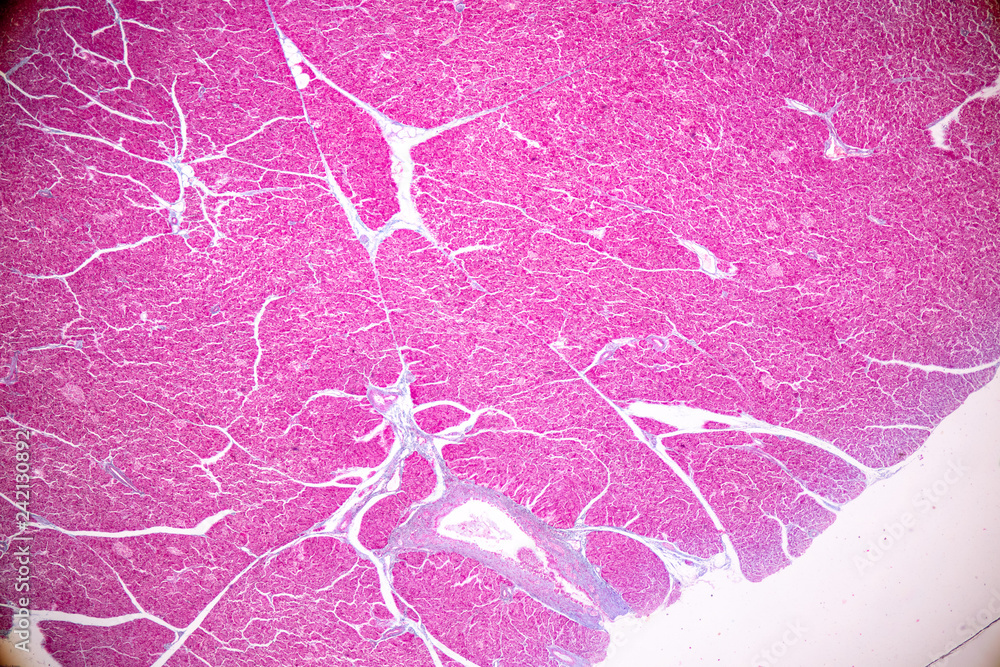 Tissue of pancreas is an organ of the digestive system and endocrine ...