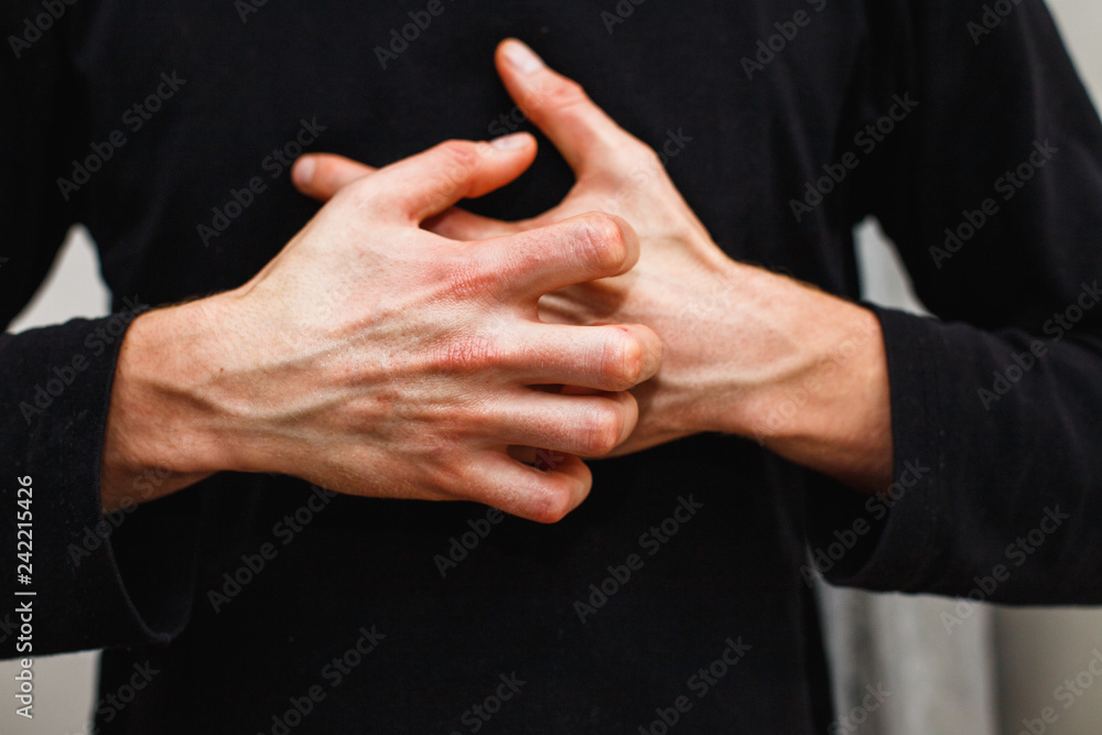 Man scratch oneself, dry flaky skin on hand with psoriasis vulgaris ...