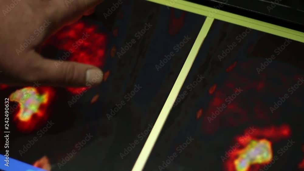 Doctor is checking body scan metabolic activity. A CT scan, also known ...