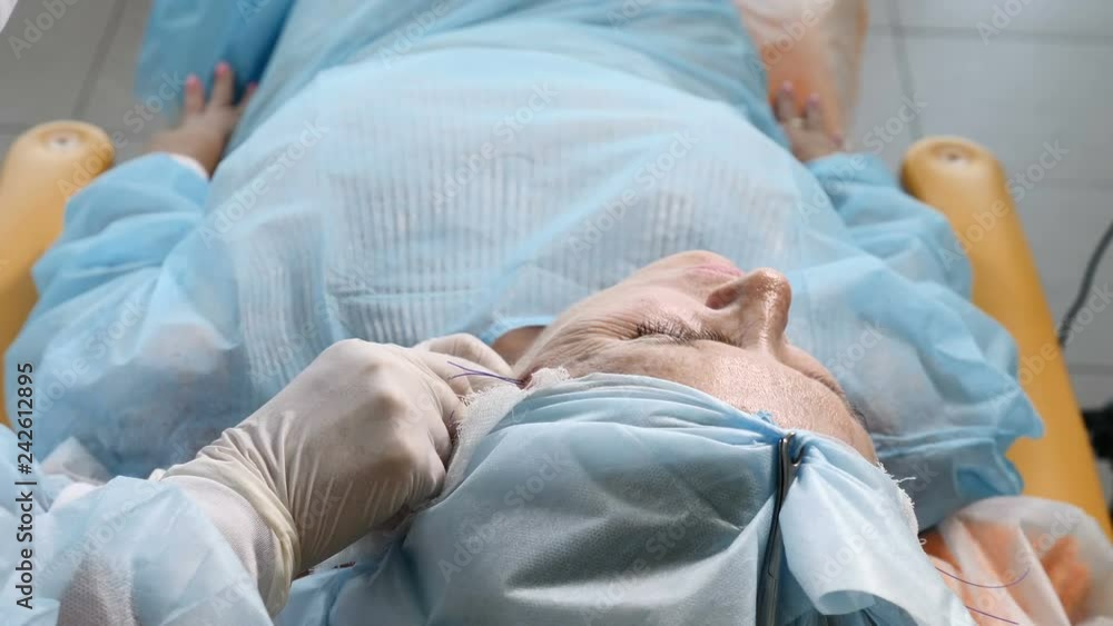 Beauty surgical operation to hide signs of aging. Flaccid face skin ...