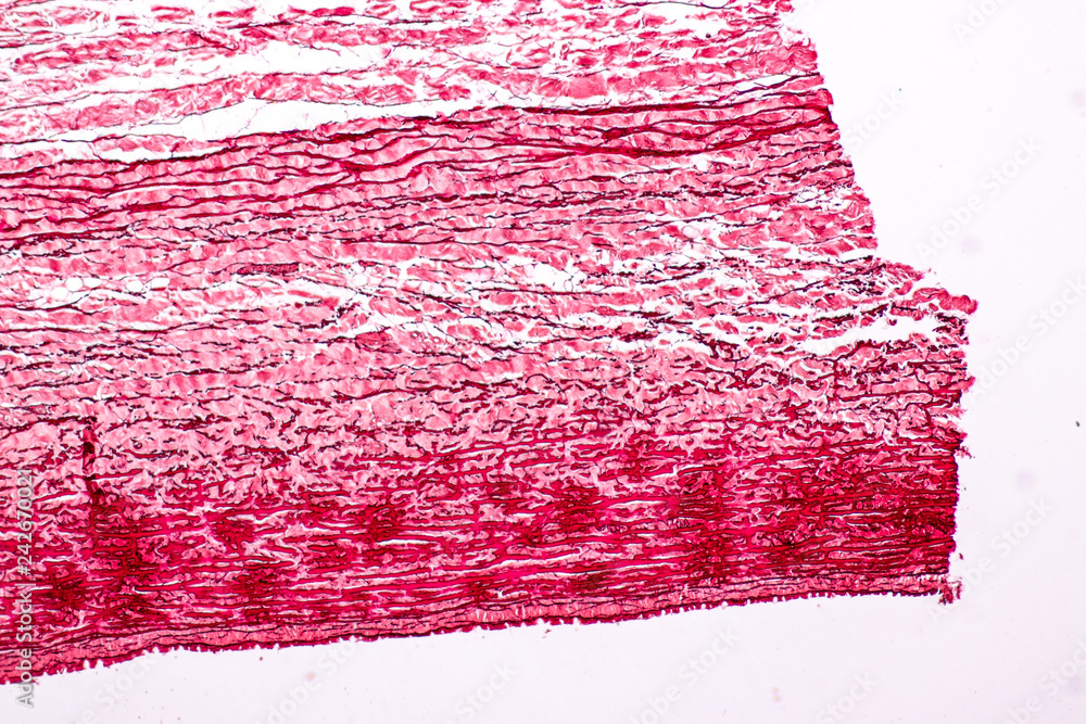 Tissue of Arteries and Veins under the microscopic, Physiology of the ...