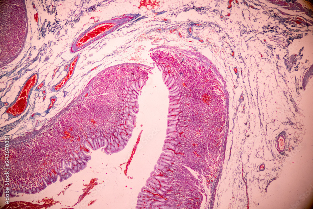 Tissue of Stomach under the microscopic, Physiology of the stomach for ...