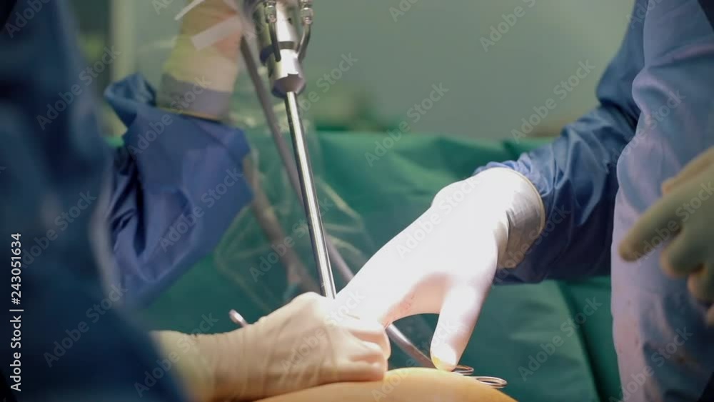 Laparoscopy camera surgery robot in surgical room in hospital with ...