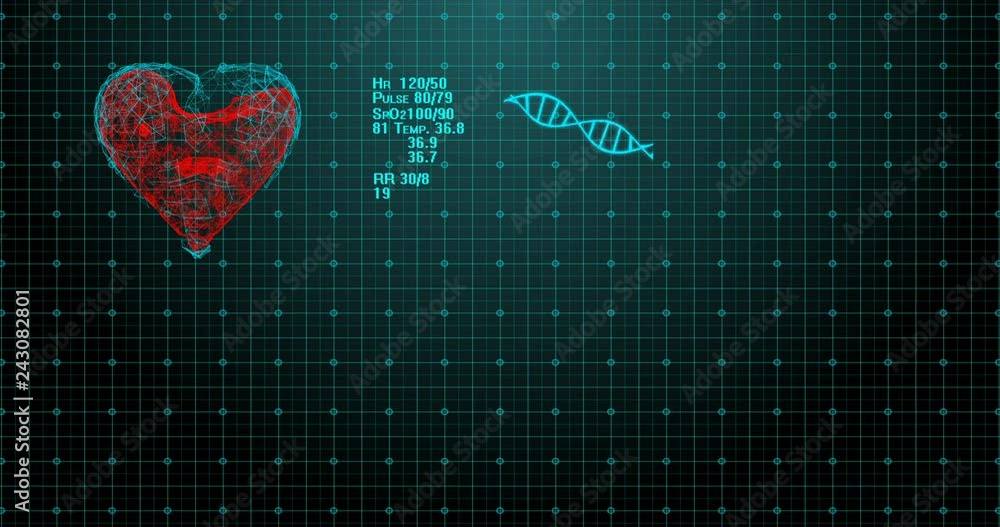 ECG cardiac monitor goes flat line. ECG showing a pulsing heart rate ...