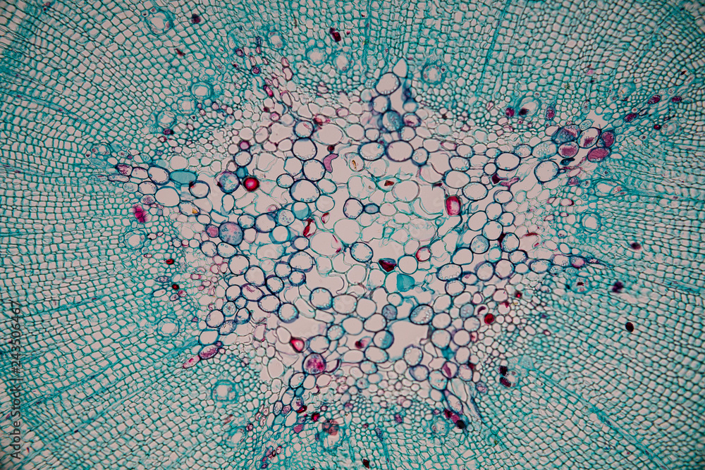 Cross Section Dicot Monocot And Root Of Plant Stem Under The Microscope For Classroom Education