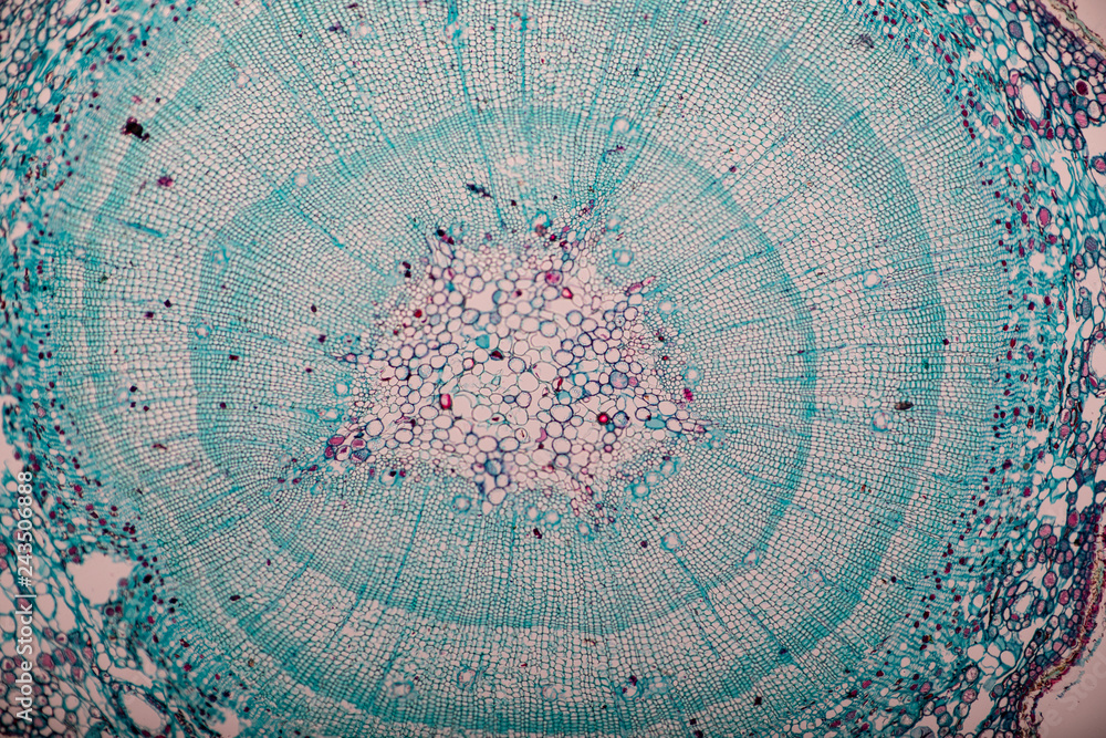 Cross-section Dicot, Monocot and Root of Plant Stem under the ...
