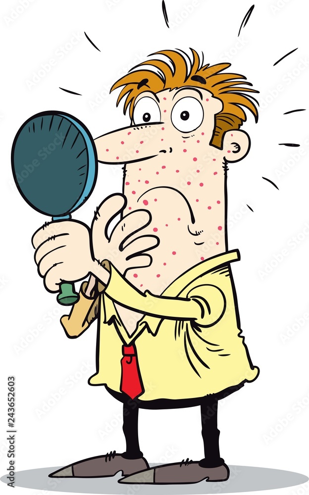 face, pimple, man, acne, skin, vector, illustration, cartoon, male ...